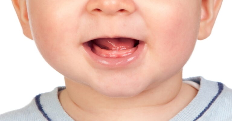 Baby Has No Teeth? 4 Known Reasons for Late Teeth Eruption