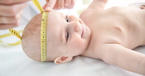Baby's Head Shape: 8 Reasons for Uneven Skull, When to Worry